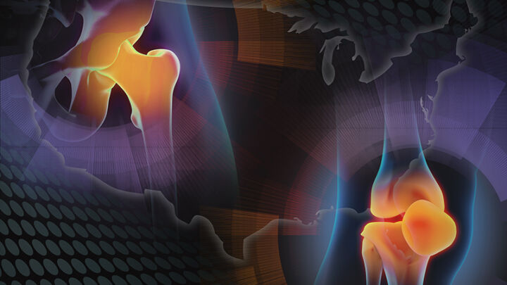 American Joint Replacement Registry (AJRR) - Dynamite Ideas
